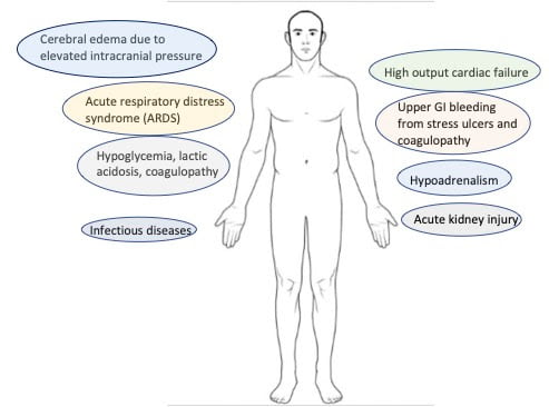 Acute Liver Failure and its Management - Dr Divakar Jain