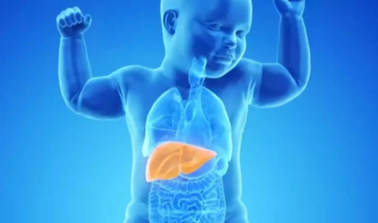 Pediatric liver transplant - Dr Divakar Jain