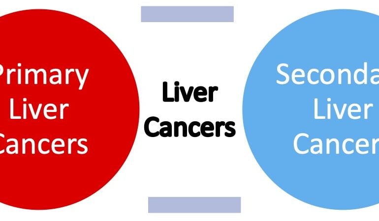 Non-surgical management of liver cirrhosis - Dr Divakar Jain