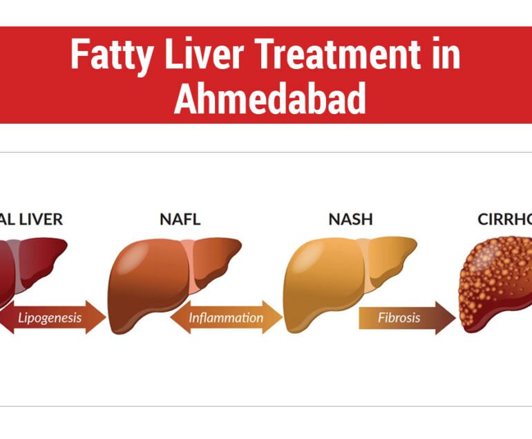 Fatty liver - A silent pandemic - Dr Divakar Jain
